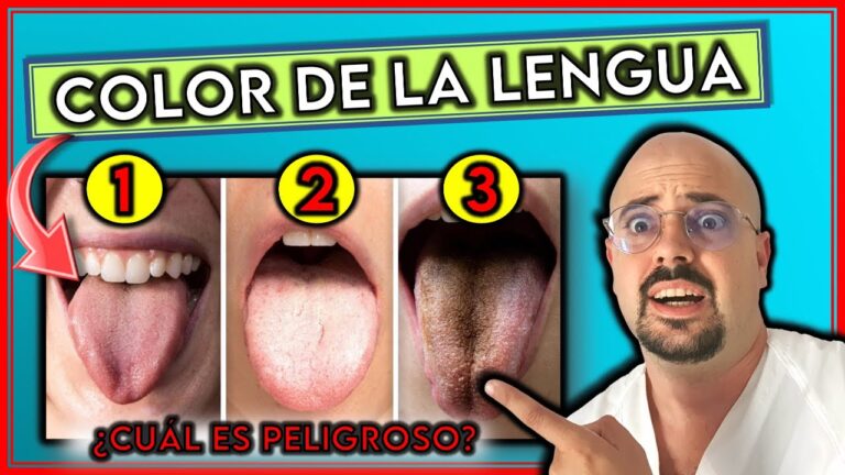 Colores de la Lengua y su Significado: ¿Qué Revela Tu Salud ...